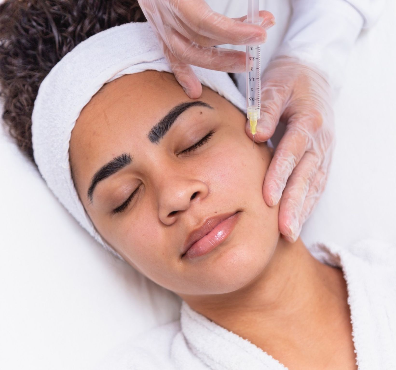 Derma PRP Filler in Orlando, FL | Secret Aesthetics